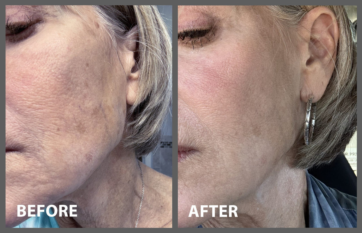 2 Minute Miracle Peptide+ Serum – Ice Elements